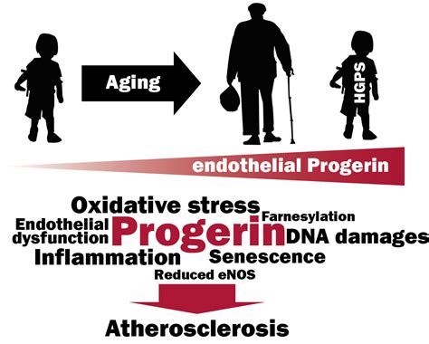 Cells Free Full Text Progerin Expression Induces Inflammation Oxidative Stress And