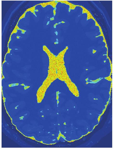 WITH PHASE CYCLED BSSFP MRI CONSTRAINED ELLIPSE FITTING FOR EFFICIENT