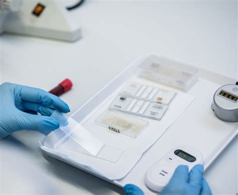 When To Get Tested For Stds After Sex