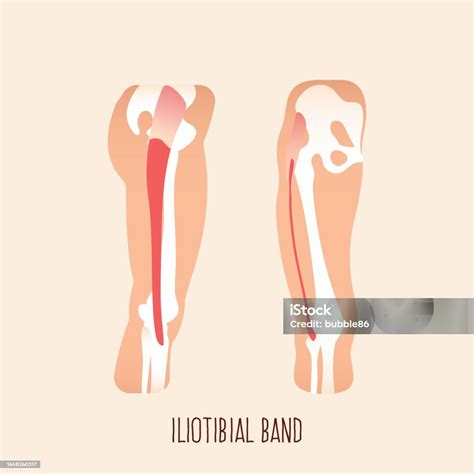 Iliotibial Band Diagram It Band Syndrome Symptoms And Treat
