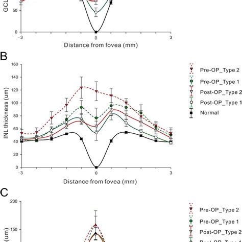 Thickness Profiles Of Different Intra Retinal Layers Measured