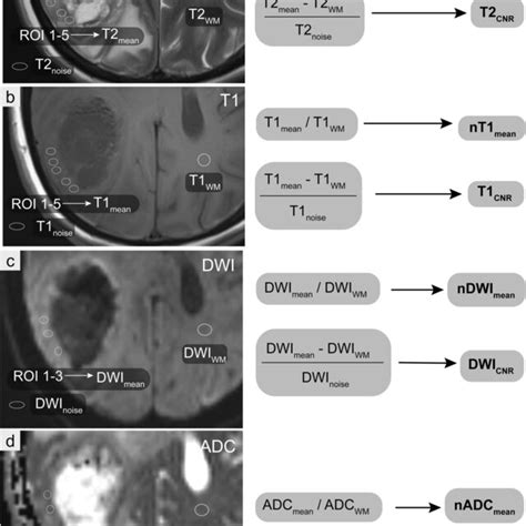 Decision Tree To Stratify The Brain Metastases Primary Tumour Entity