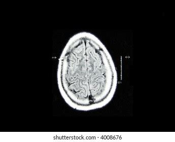 Real Mri Mra Magnetic Resonance Angiogram Stock Photo 4008676 Shutterstock