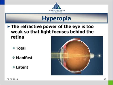 Refractive Errors Prof Dr Şule Ziylan Ppt Download