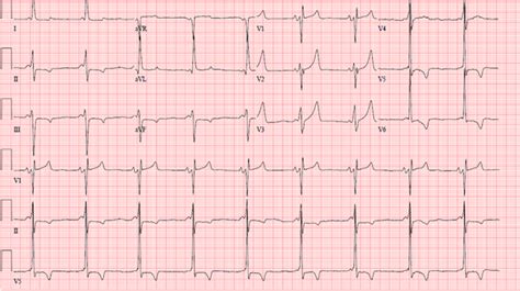 Online Learning Catalog American College Of Cardiology