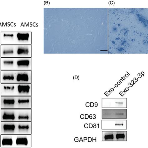 Identification Of Human Adipose Tissue Derived Mesenchymal Stem Cells