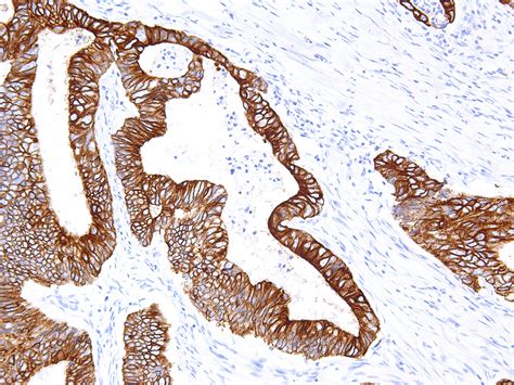 Anti Cytokeratin 18 Monoclonal Antibody Cloneihc01844 1027