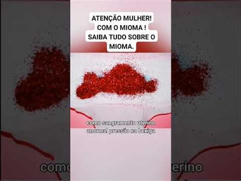 O que Mioma Pode virar câncer YouTube