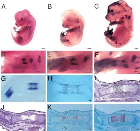 Runx3 Expression In Runx3 − Mice And Skeletal Development In Runx3