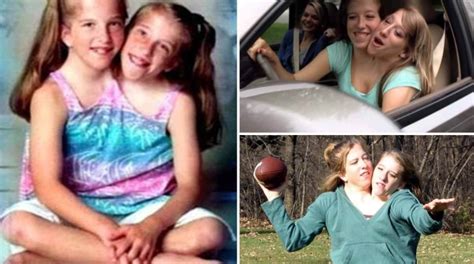 Conjoined Twin Sisters Abby And Brittany Hensel Where Are They Now Viral Daily