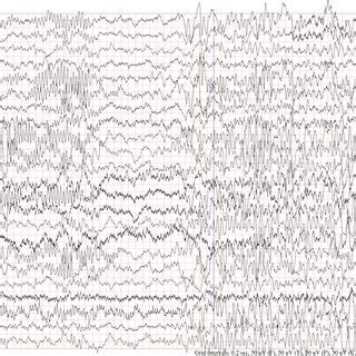 Public MI EEG Datasets Download Table