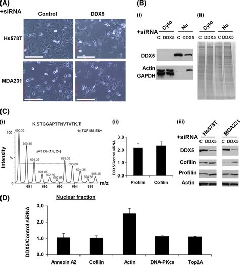 Effects Of Ddx5 Knockdown On Actin Cytoskeleton In Basal Breast Cancer