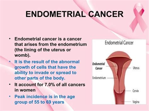 Reproductive Tract Malignancy Ppt