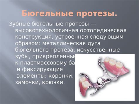Виды частичных съемных протезов Способы их фиксации презентация онлайн