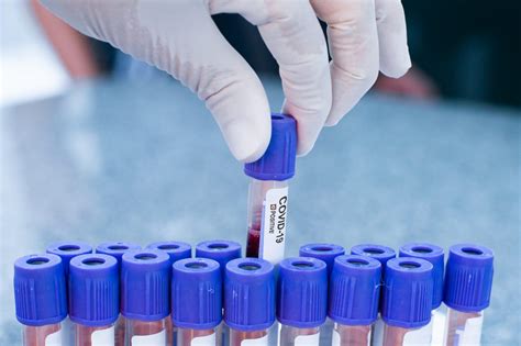 Cdc Asymptomatic Carriers Spread More Than Half Of All Covid 19 Cases