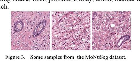 Figure 3 From Improving Nuclei Segmentation In Pathological Image Via