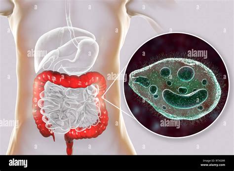 Balantidiasis Conceptual Image Computer Illustration Showing Close Up