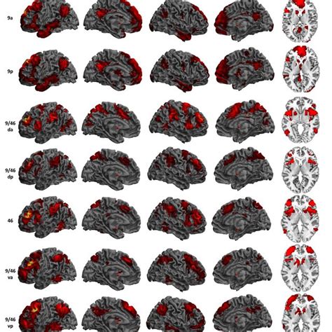 Functional Connectivity Patterns Of The Dlpfc Seed Regions Download