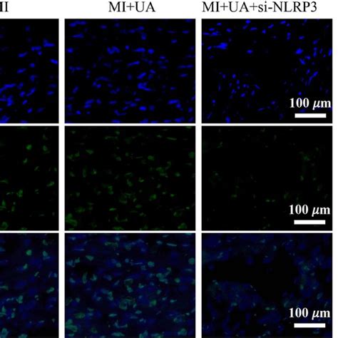 Knockdown Of Nlrp3 Reversed The Influence Of Ua On Cardiomyocyte