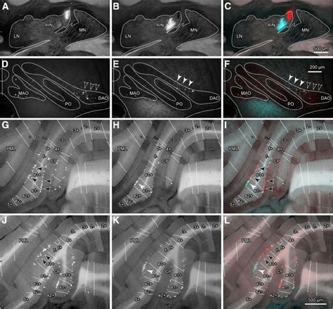 Retrograde Tracer Injections Into The Cerebellar Nuclei A Example Of Download Scientific