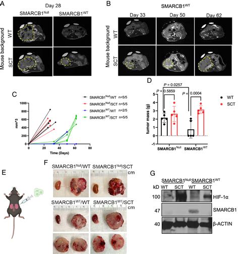 SMARCB1 Regulates The Hypoxic Stress Response In Sickle Cell Trait PNAS