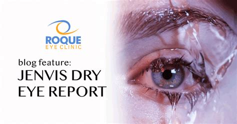 Jenvis Dry Eye Report Roque Eye Clinic Ph