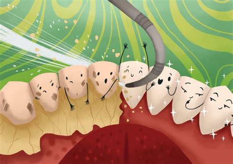 How Dental Hygienists Clean Teeth What You Need To Know Tooth Be Told