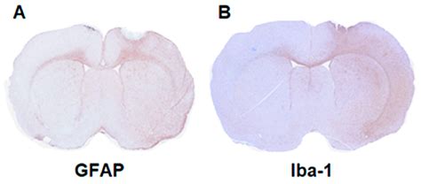 Immunohistochemical Staining For The Presence Of Microglia And
