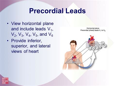 The Electrocardiogram Ppt Video Online Download