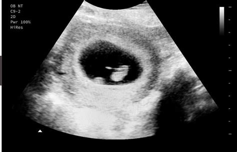 Customizable Fake Digital Ultrasound Prank T Fake Ultrasounds