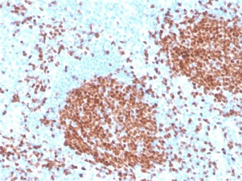 Pax5bsap Early B Cell Marker Monoclonal Antibody Rpax54228 5079