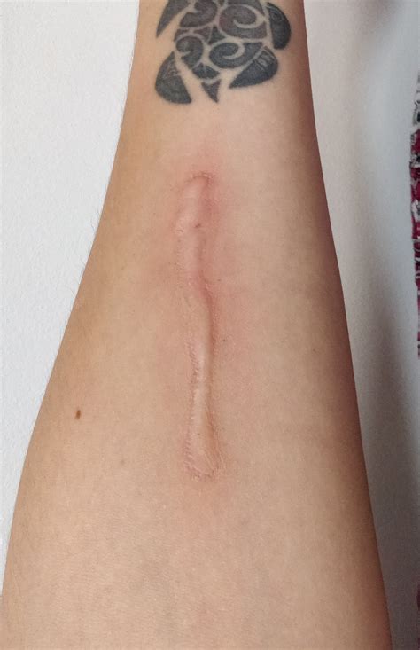 Realistic Surgical Scar Prosthetic Appliance Etsy