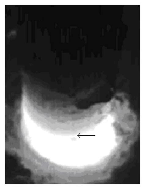A Original Image B Result Of Gray Gradient Detection Arrows