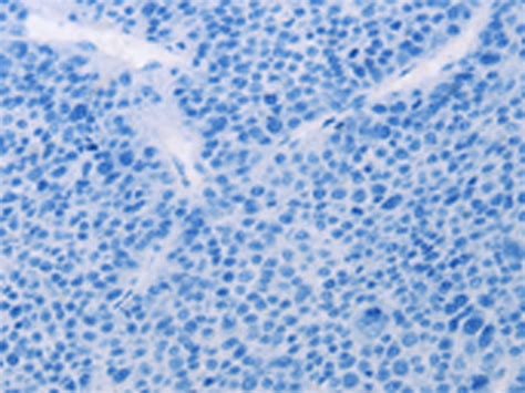 兔抗acta1多克隆抗体anti Acta1 Rabbit Polyclonal Antibody 生命科学产品与技术服务 生工生物工程