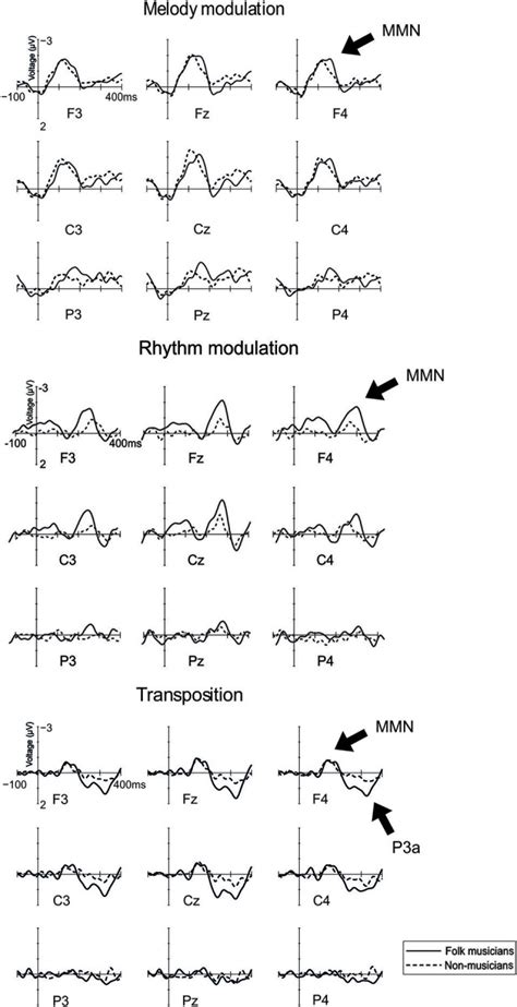 Brain Responses To Rhythm Modulation Melody Modulation And
