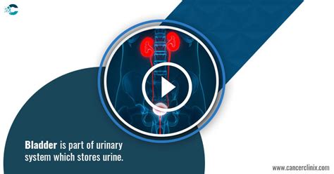 Bladder Tumour Is Common Says Urinary Bladder Cancer Doctor In
