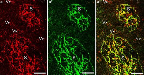 Double Label LSM Comparing The Immunolocalization Of The Plaque Protein