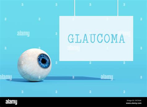 Glaucoma Disease 3d Rendering Of A Human Eye Looking At A Sign That Says Glaucoma On A Blue
