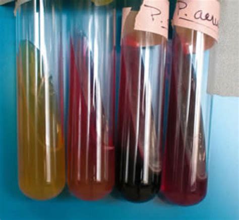 Kia Summary Of Biochemical Tests Additional Info Molb 2021