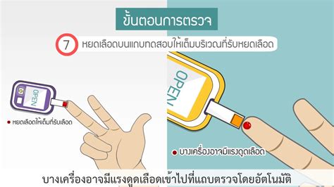การตรวจระดับน้ำตาลในเลือดด้วยตัวเอง Youtube