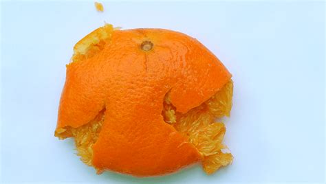 Mans Testicle Pops Out Of His Scrotum After Rare Complication From