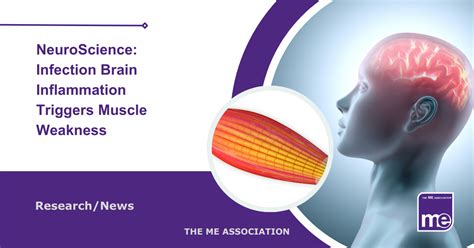 Neuroscience Infection Brain Inflammation Triggers Muscle Weakness