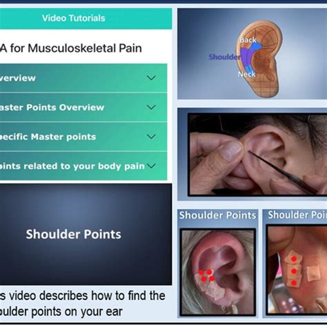 App For Chronic Musculoskeletal Pain Download Scientific Diagram