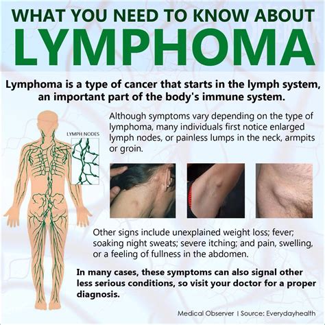 Swollen Lymph Nodes Groin Female Pictures Stattalk