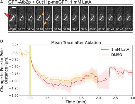 Actin Depolymerization With Latrunculin A Does Not Affect Spindle