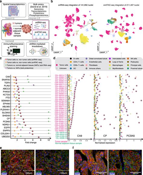 Snrna Seq Analysis Identifies Tumor Cell Specific Markers A Schematic