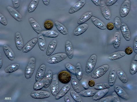 Chilomonas Ciliés Mikroscopia