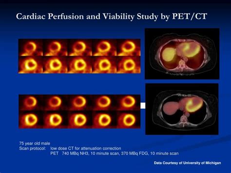 Ppt Myocardial Viability Powerpoint Presentation Id 5695177