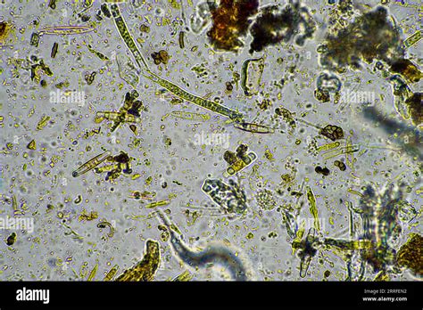 Soil Microorganisms Close Up Under The Microscope In A Soil Samlple