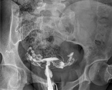 Image Radiopaedia Org